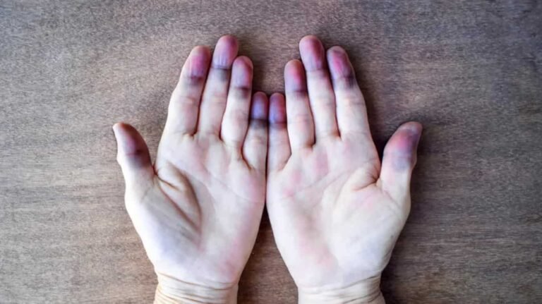 Spiritual Meanings of Cold Hands: 9 Hidden Body Messages